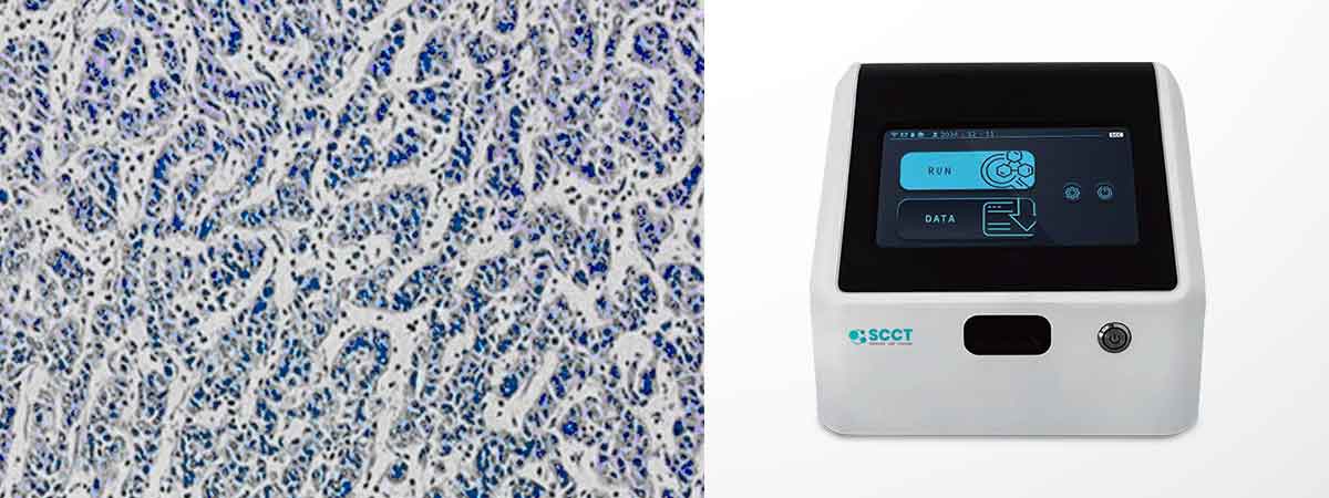 How to Bring Down High Somatic Cell Count in Dairy Cows? - SCCT