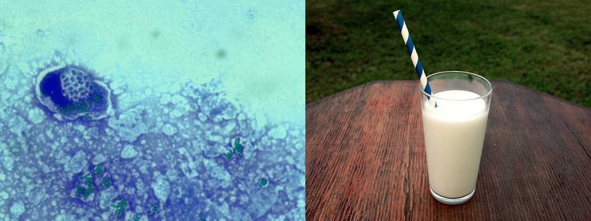 Causes of High Somatic Cell Count in Milk and Their Impact on Milk ...