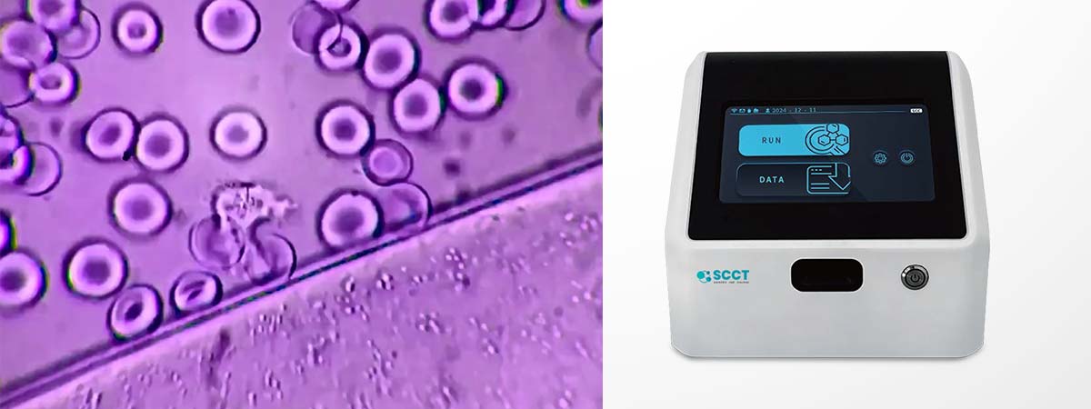 How to Bring Down High Somatic Cell Count in Dairy Cows? - SCCT