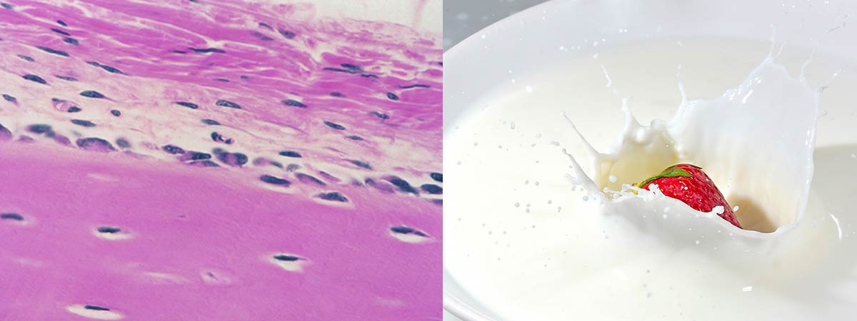 How to Calculate Somatic Cell Count in Milk? - SCCT