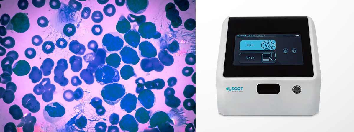 Understanding the Somatic Cell Count Tester for Dairy Farmers - SCCT