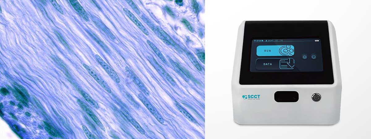 Understanding the Somatic Cell Count Tester for Dairy Farmers - SCCT