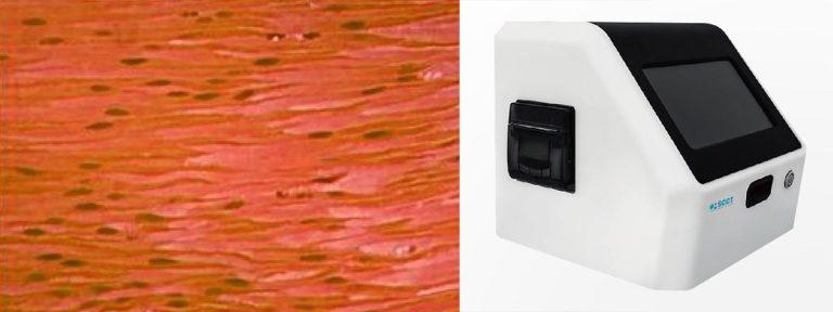 SCC Units Explained with the Meaning of Cells per mL - SCCT