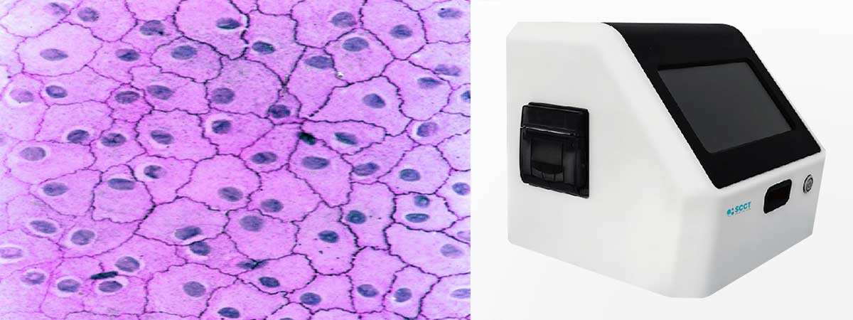 Unboxing Experience of Using the Somatic Cell Count Tester for the ...