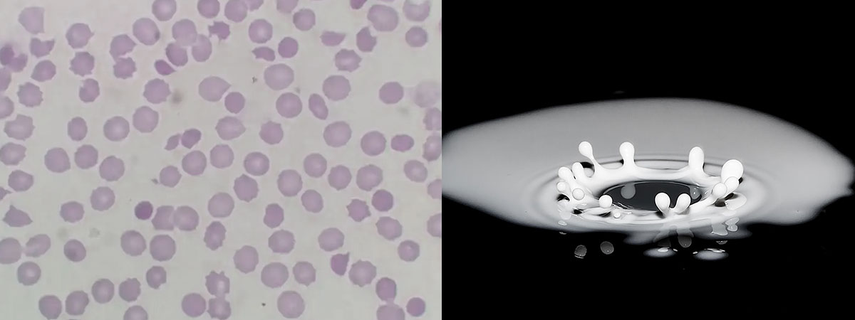 Can Seasonal Changes Affect Somatic Cell Count? - SCCT