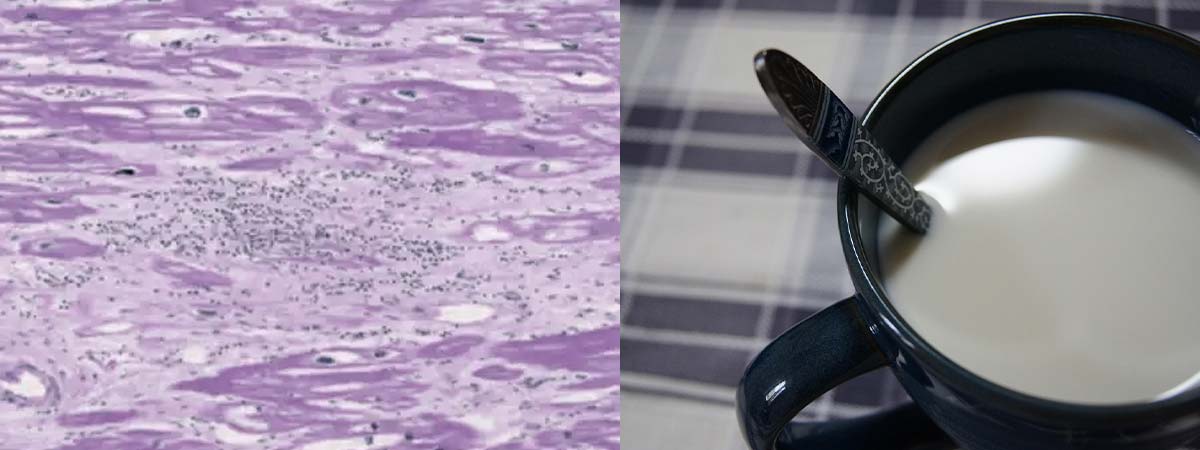 10 Must-Know Facts About Somatic Cell Count - SCCT