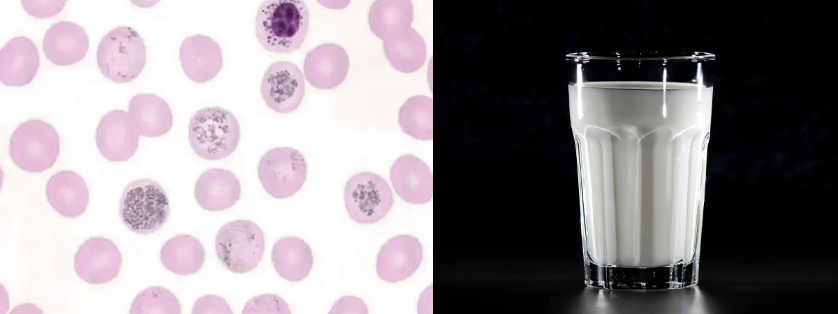 Types of Somatic Cells in Milk and Their Role in Dairy Production - SCCT