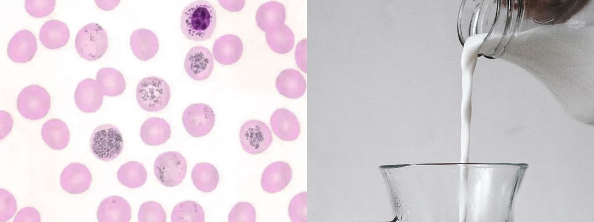 Practical Tips for Bulk Tank Milk Sampling in Mastitis Treatment - SCCT