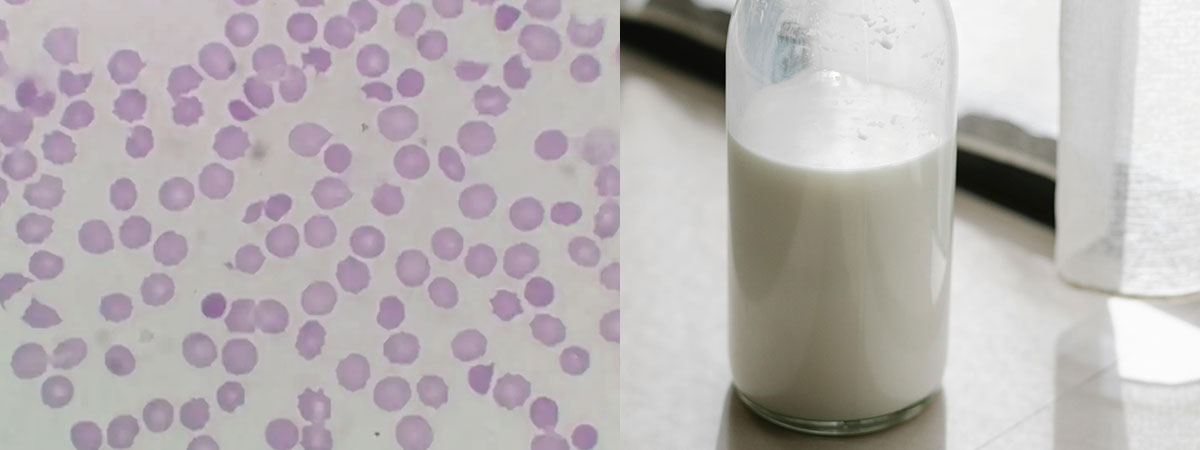 How to Collect the Perfect Milk Sample for Accurate Somatic Cell Count ...