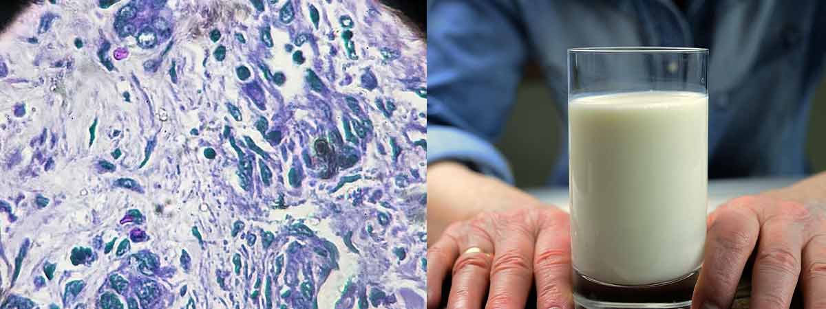 Best Practices to Minimize Contamination in Milk Collection for Somatic ...