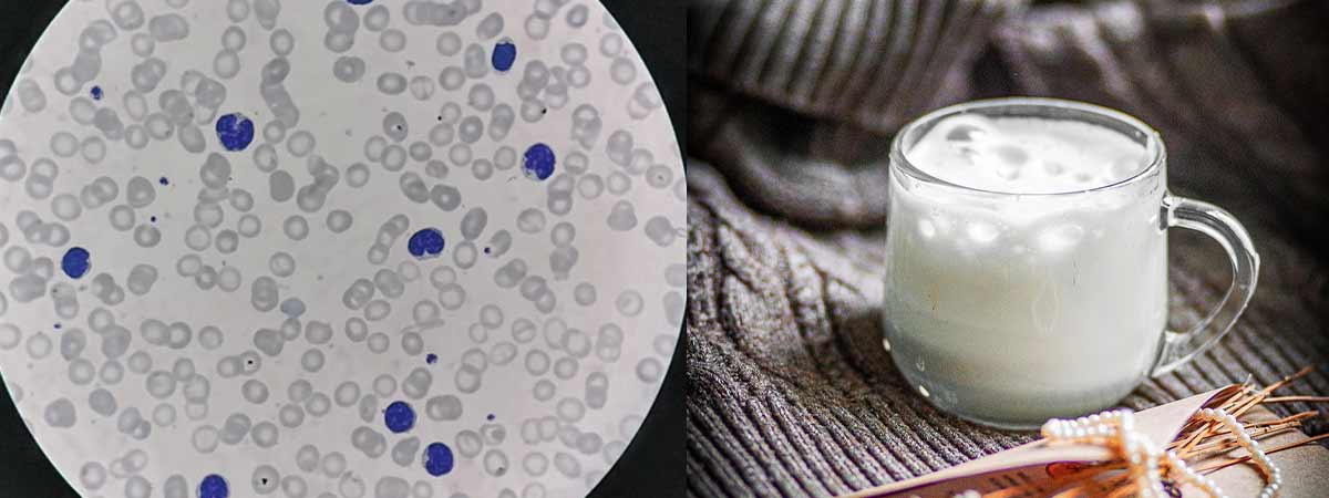 Tracing the Evolution of Somatic Cell Counting in Dairy Science - SCCT