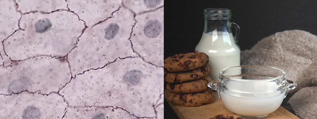 Tracing the Evolution of Somatic Cell Counting in Dairy Science - SCCT