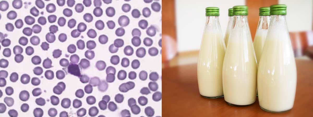 Types of Somatic Cells in Milk and Their Role in Dairy Production - SCCT