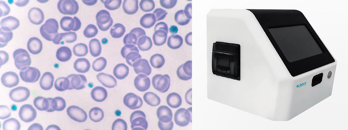 How Somatic Cells and White Blood Cells Differ in Function and ...