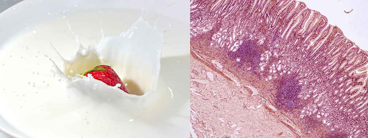 Simplifying Somatic Cell Count Evaluation with the Linear Score Method ...