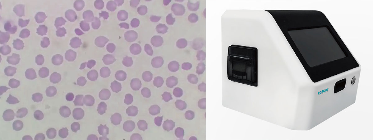 Leveraging Historical Data for Smarter Somatic Cell Count Risk ...