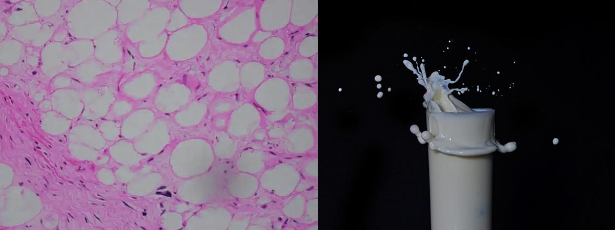 Setting Action Thresholds for Somatic Cell Count on Your Farm - SCCT