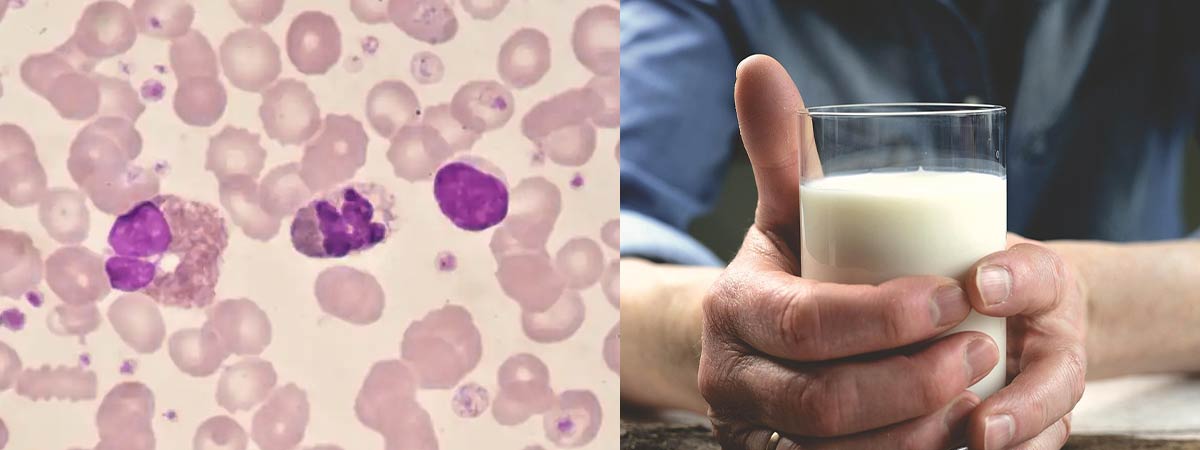 Bulk Tank Somatic Cell Count Trends Every Dairy Farmer Should Know - SCCT