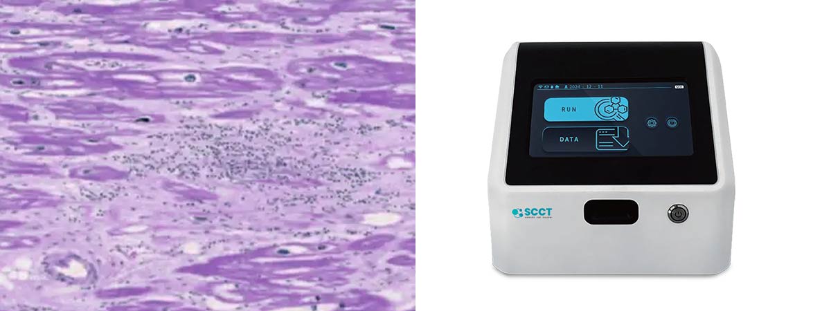 Syncing Somatic Cell Count Data with Your Farm Management Software - SCCT