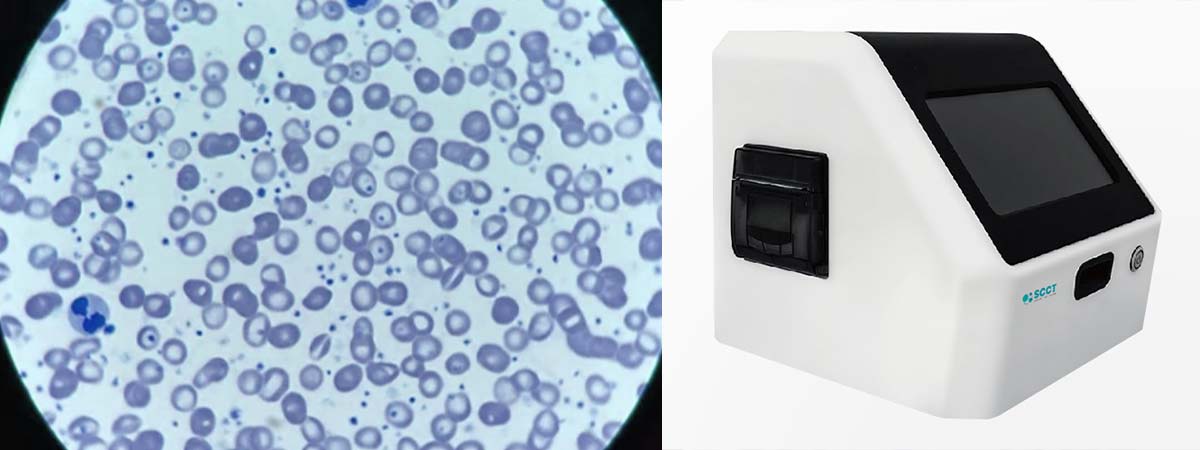 How Somatic Cell Count Tester Helps Identify Contagious and ...