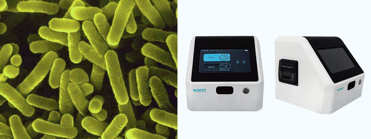 Differences in SCC Profiles Between Strep. agalactiae and Strep. uberis ...