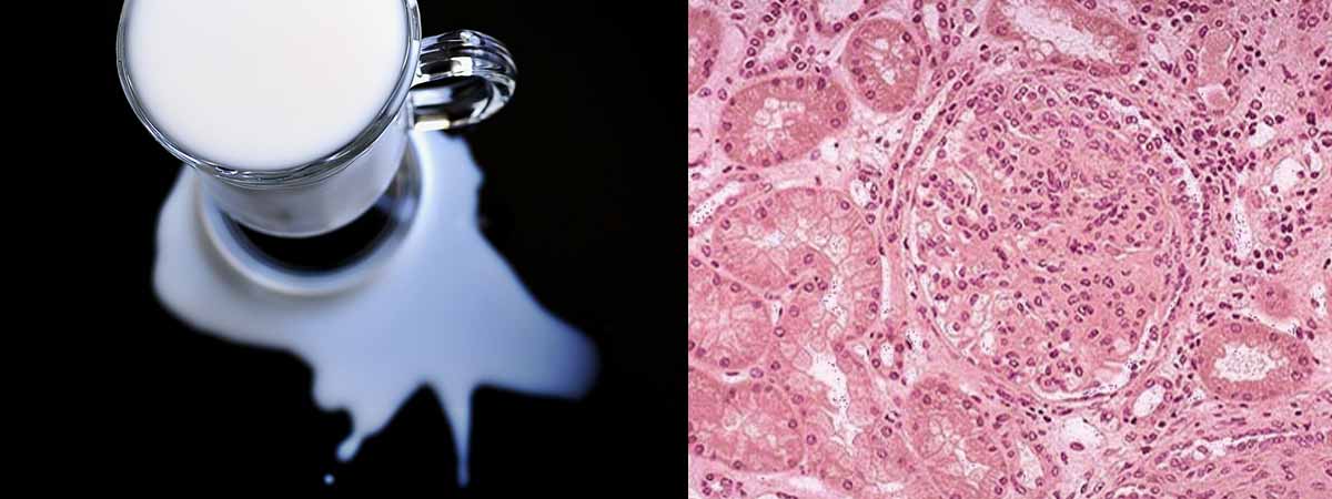 Silent Spread of Mycoplasma Mastitis in Multiple Udder Quarters - SCCT