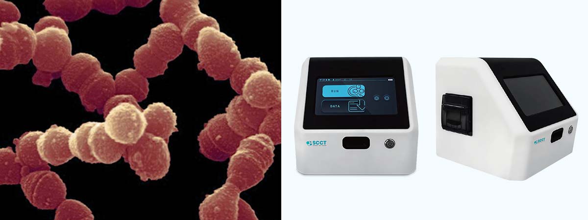 What a Staphylococcus aureus Infection Looks Like in Somatic Cell Count ...
